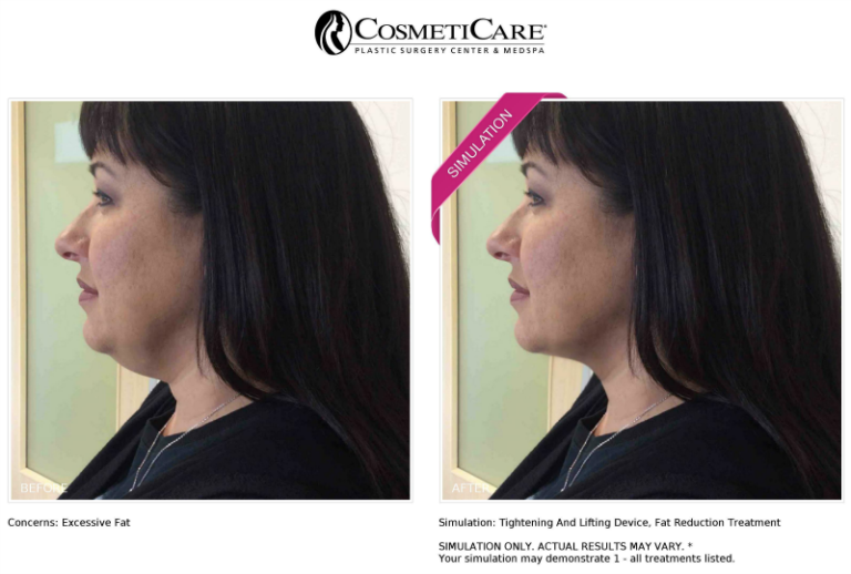 Trying On A Treatment With A New Look Now at CosmetiCare