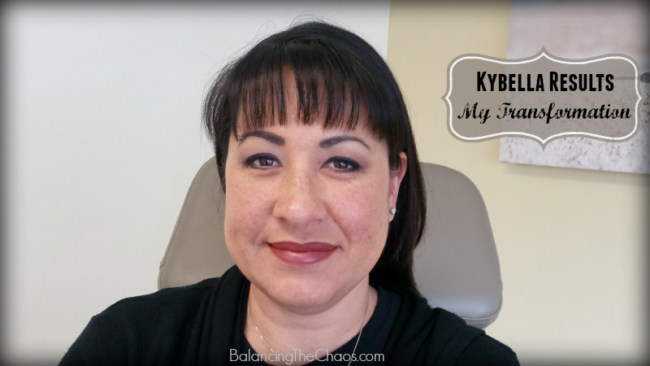 Kybella Results - My Transformation with CosmetiCare - Balancing The Chaos