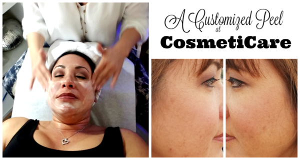Bringing Back My Skin's Youthful Glow with a Customized Peel at ...